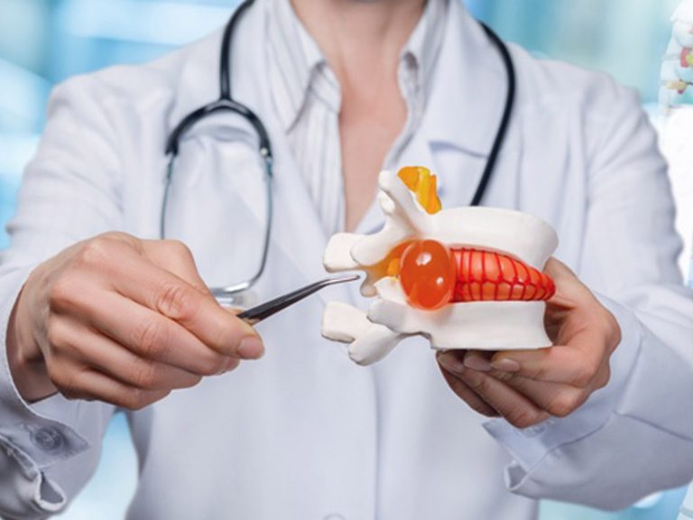 HERNIATED DISCS - Beirut Spine Center